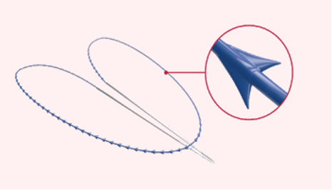 Overview of Different Thread Types at Skin Renewal Clinics