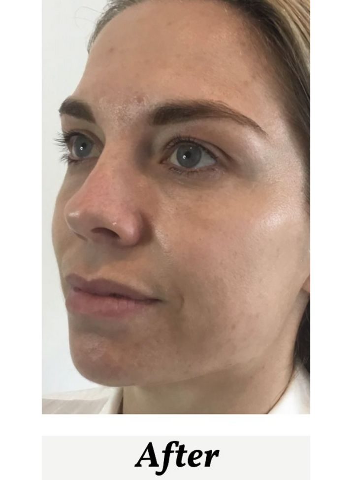 Minki Season 6 | Episode 7 | Zara Conradie | Skin Renewal